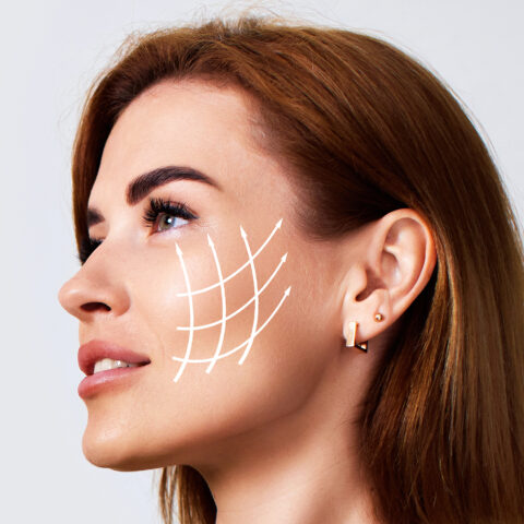 Lifting temporal não cirúrgico - Dra Daniele Guerra Daros